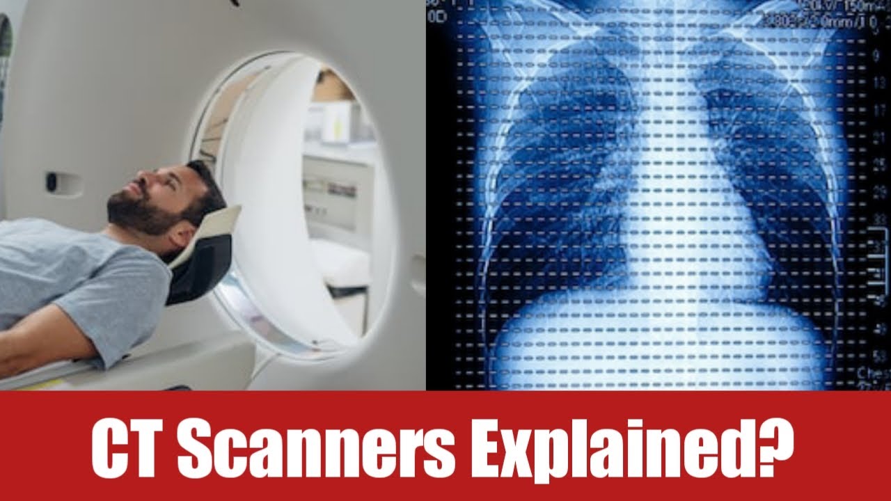 How Does CT Scanners Works? Let's Scan Hidden Truth 😜😜😉 - YouTube