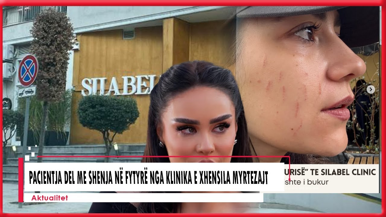 Pacientja del me shenja në fytyrë nga klinika e Xhensila Myrtezajt ...