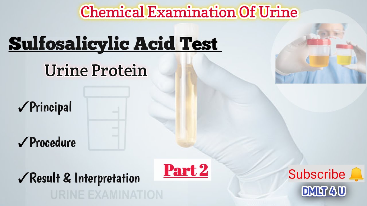 #Sulfosalicylic Acid Test #chemical examination of urine part-2 #dmlt# ...
