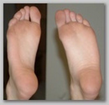 RE: Erectile Dysfunction and Reflexology - YouTube