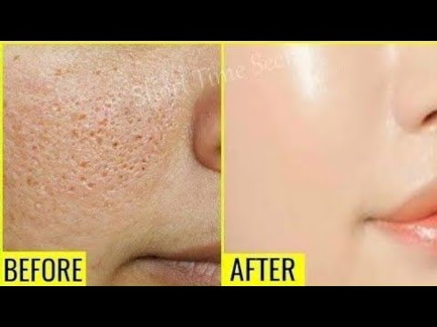 Get Poreless Skin At Home - YouTube
