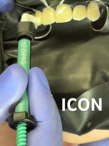 Icon bei MIH. Zahnmedizin - YouTube