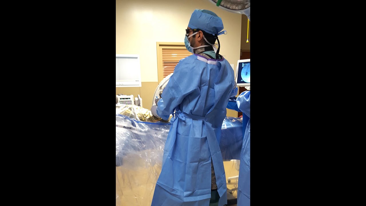 Left L5 S1 Interlaminar Endoscopic Discectomy For A Cranial Extrusion 8583