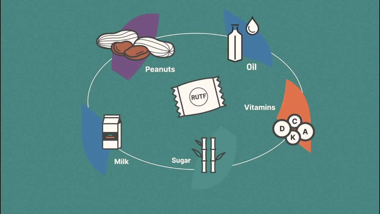 Eleanor Crook Foundation | Ready-to-Use Therapeutic Foods Explained ...