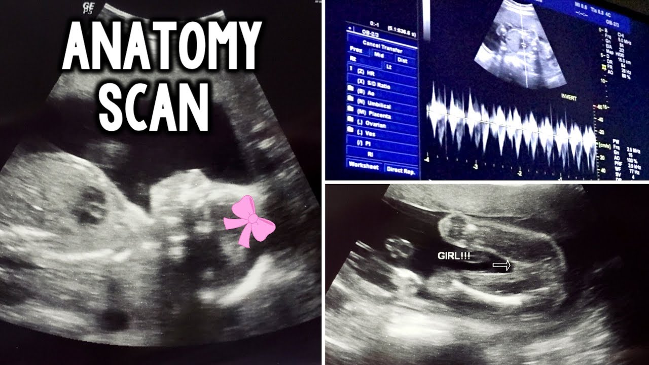 ANATOMY SCAN 21 WEEKS ULTRASOUND YouTube ANATOMY SCAN 21 WEEKS ULTRASOUND YouTube