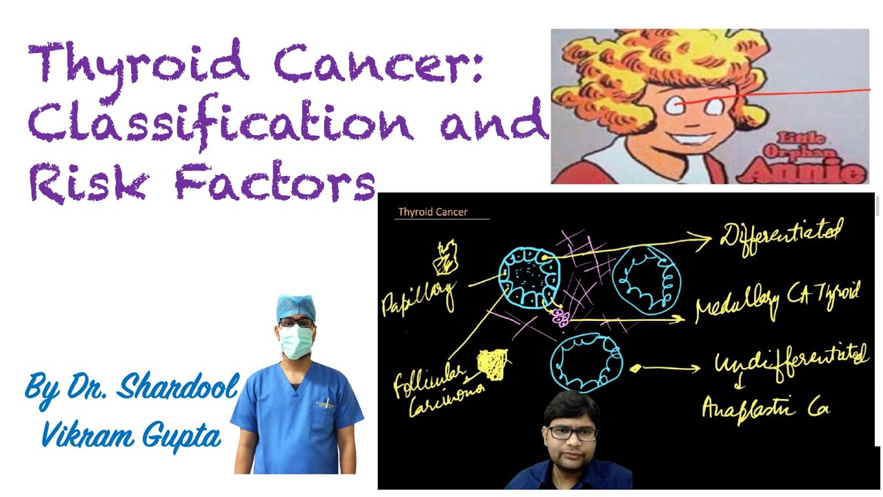 Thyroid Cancer :Classification and Risk factors for MBBS/ MS Surgery ...
