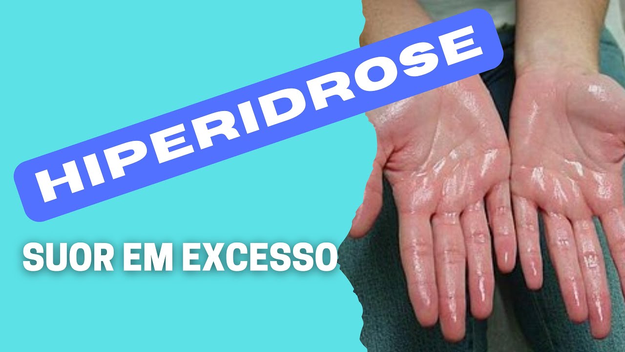 REPORTAGEM SOBRE HIPERIDROSE - SUOR EM EXCESSO - YouTube