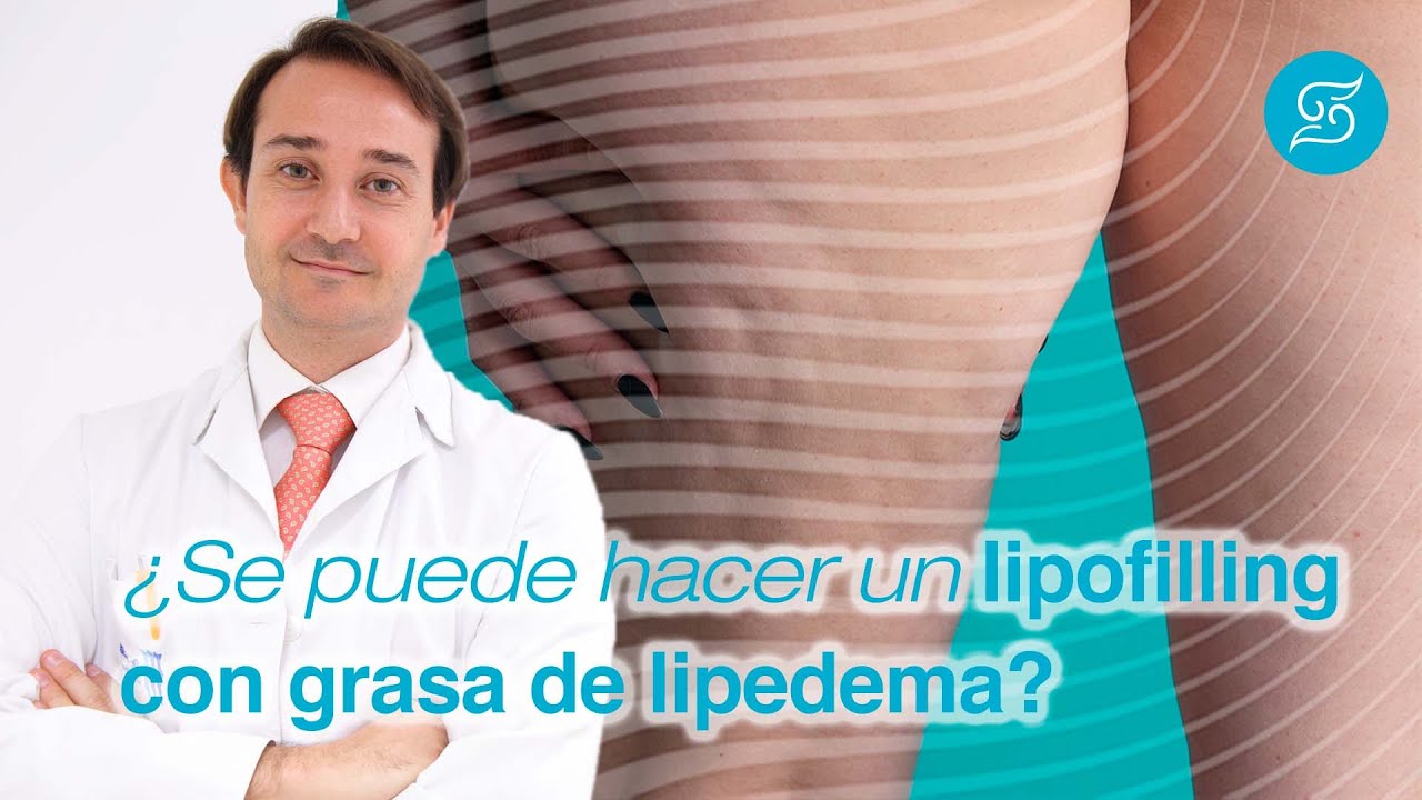 ¿Se puede hacer un lipofilling con grasa afectada por el lipedema ...