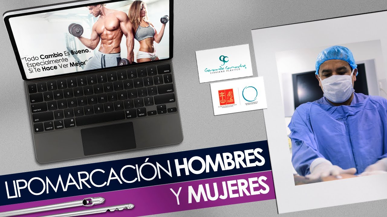 Definición abdominal - Lipomarcacion Hombres y Mujeres Dr.Gerardo ...