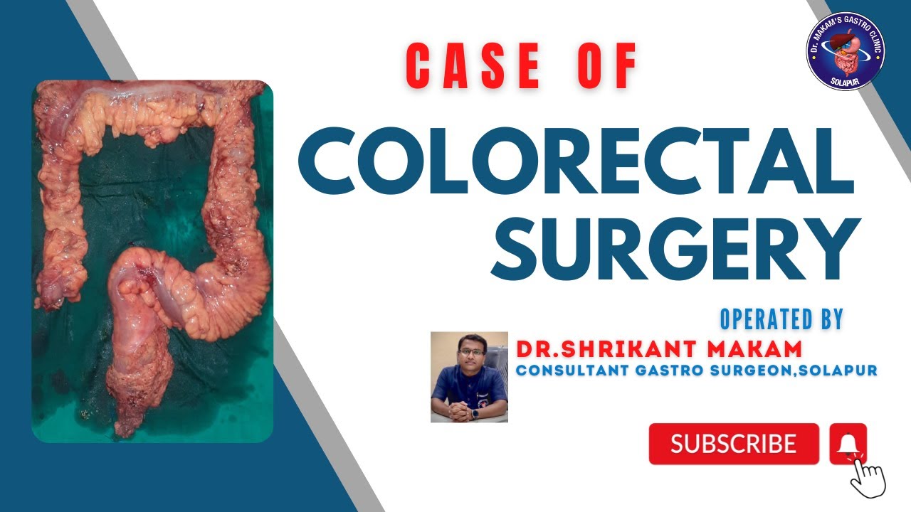 Colorectal Surgery - YouTube