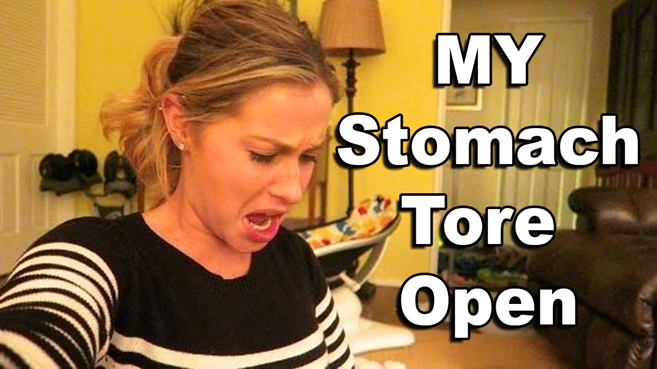 MY STOMACH TORE OPEN - YouTube