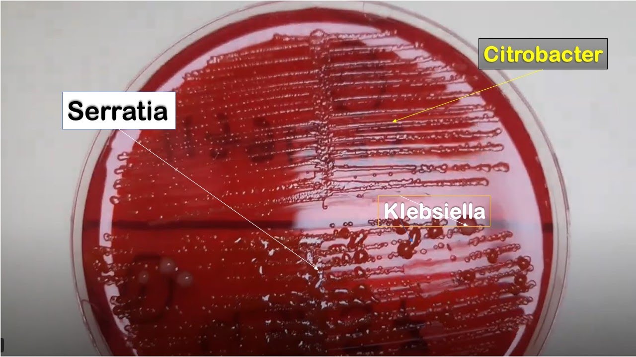 Serratia liquefaciens, Citrobacter freundii and Klebsiella pneumoniae ...