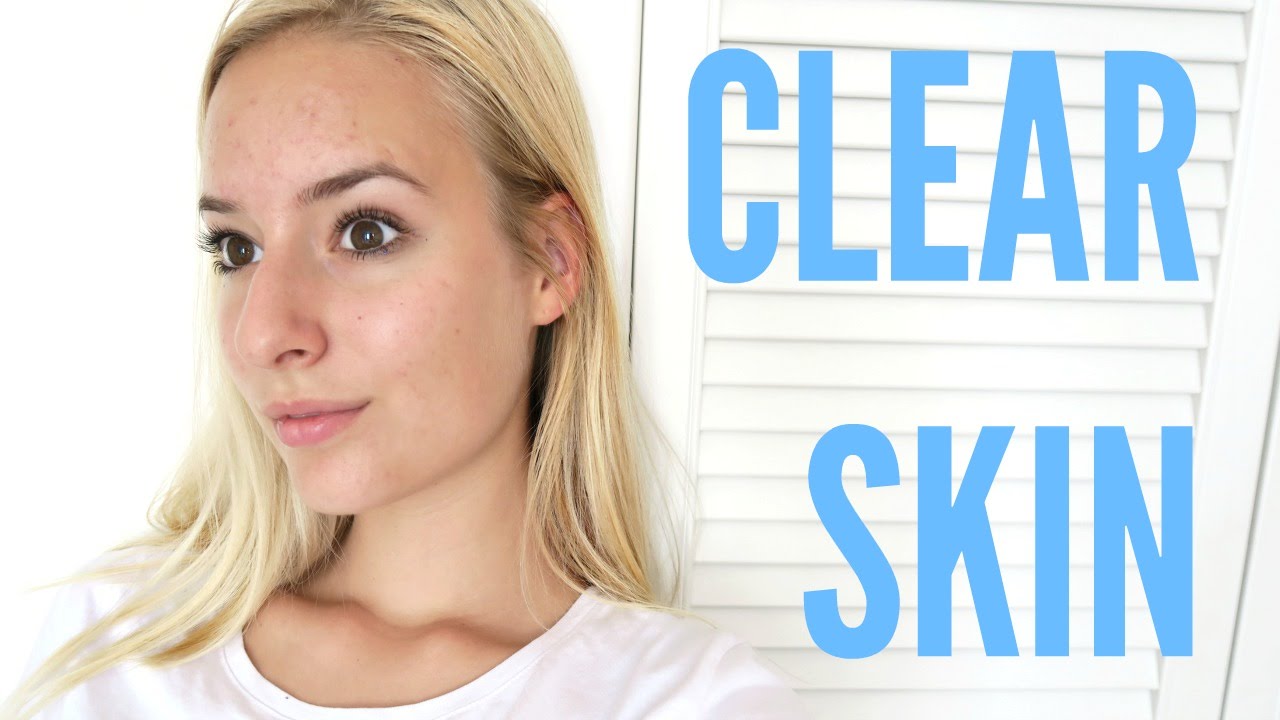 How I Cleared My Skin #MyLife | COCO CHANOU - YouTube