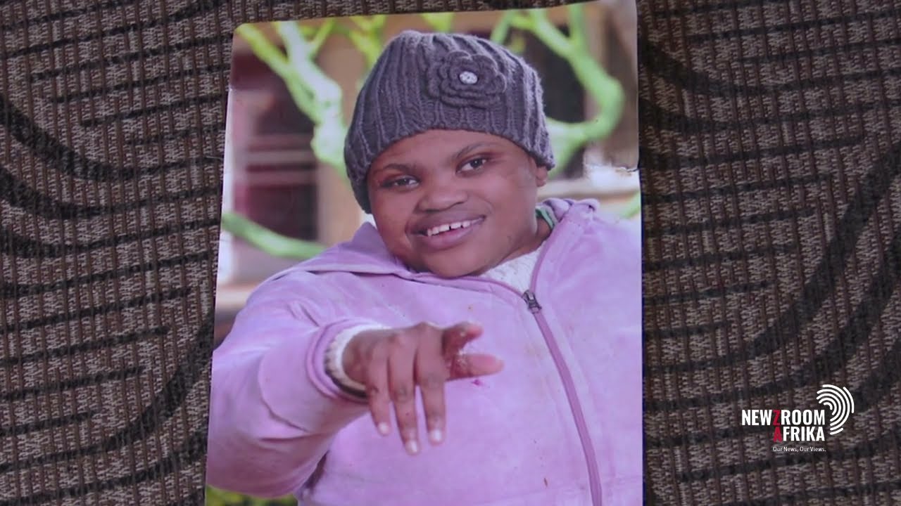 Condolences are pouring in for conjoined twin, Mpho Mathibela - YouTube