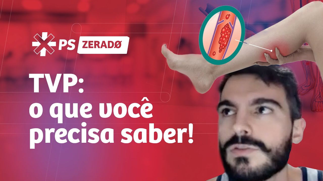 TVP o que você precisa saber! - YouTube