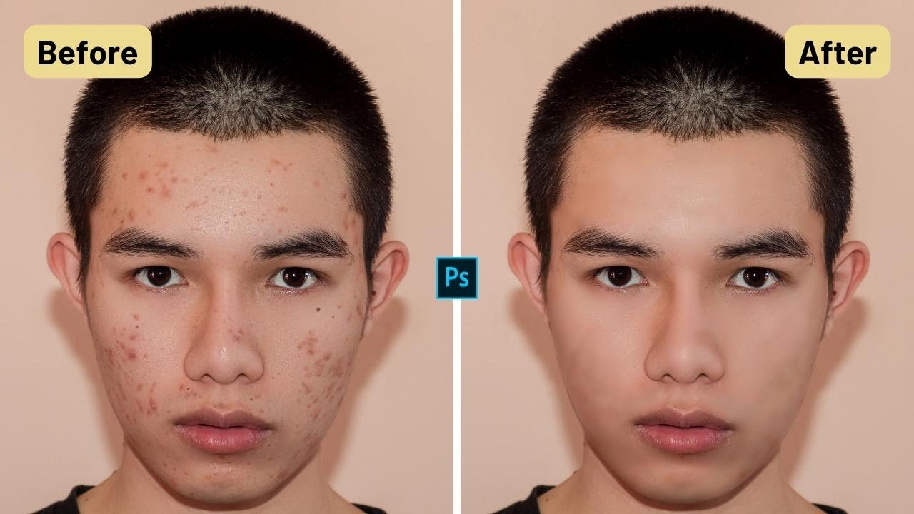 High End Skin Retouching Photoshop Tutorial | Skin Retouching Tutorial ...