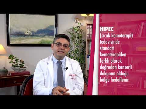 Yumurtalık kanserinde sıcak kemoterapi (HİPEC) nasıl uygulanır?