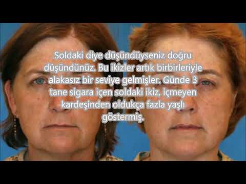 Sigaranın İkizler Üzerindeki Etkisi