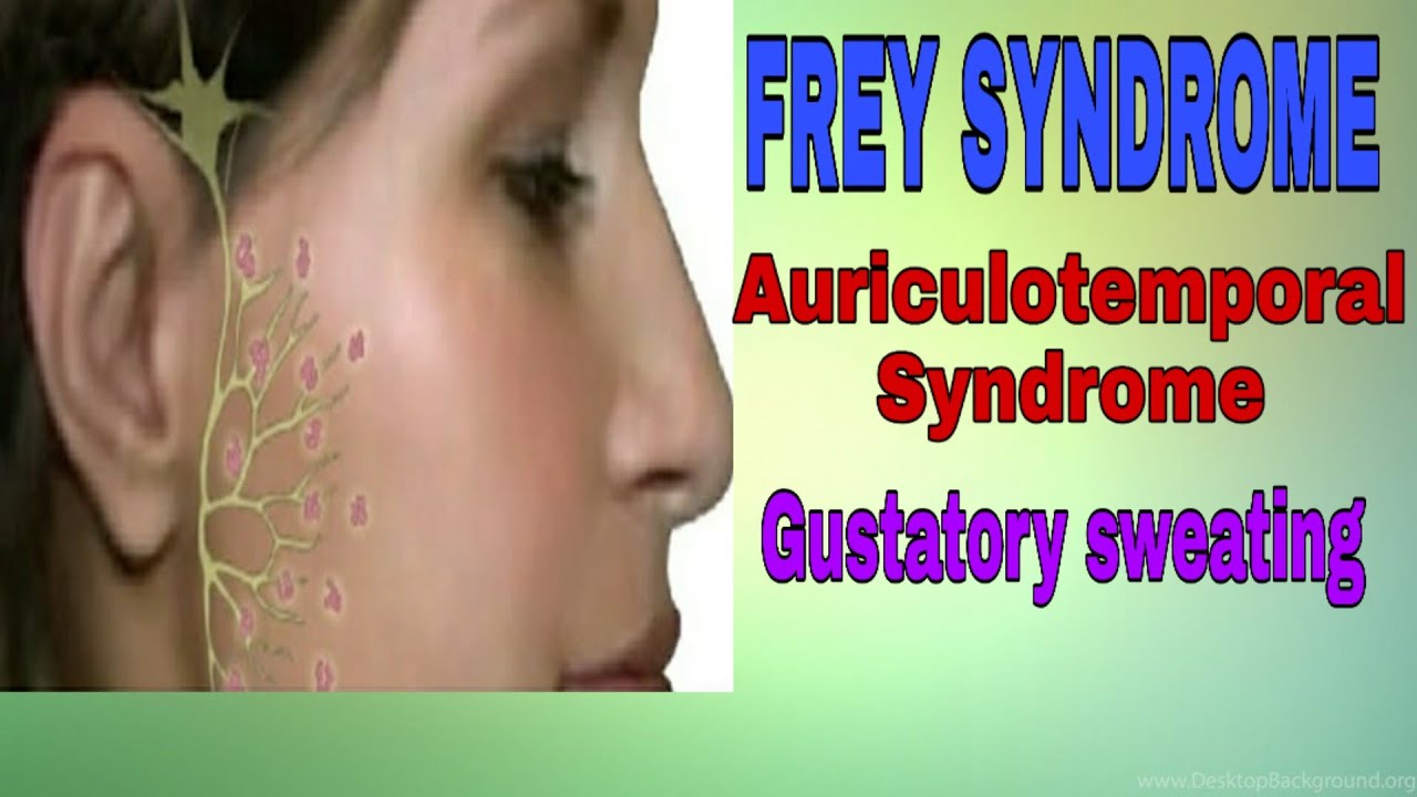 Frey Syndrome | Auriculotemporal Syndrome | Gustatory Sweating | dental ...