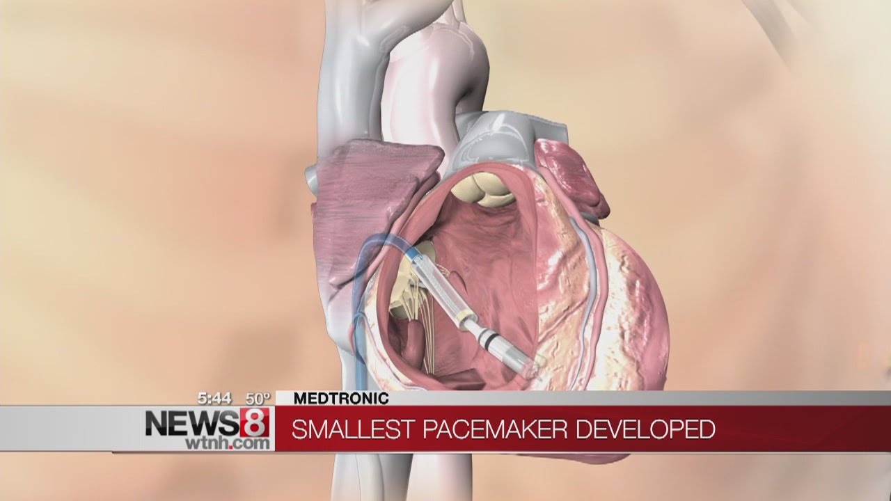 World's smallest pacemaker developed - YouTube