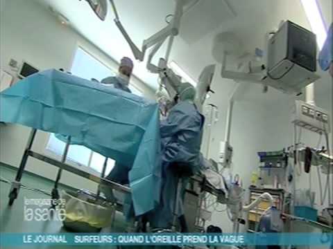 l'exostose de l'oreille 1.m4v - YouTube