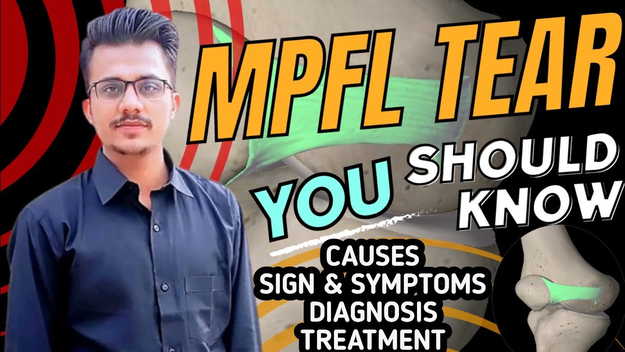 MPFL Tear | Medial Patellofemoral Ligament Tear | MPFL Injury ...