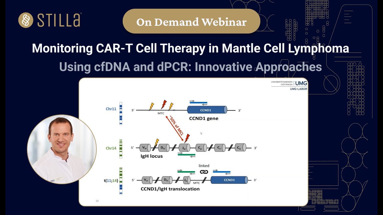 Monitoring CAR T Cell Therapy in Mantle Cell Lymphoma Using cfDNA and ...