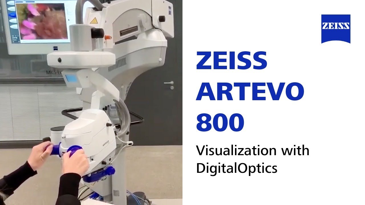 ZEISS ARTEVO 800 - Anterior segment application: Visualization with ...