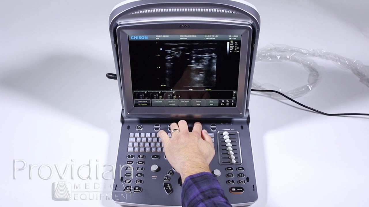 Chison ECO5 ECO 6 Training Part 2: 2D Imaging - YouTube