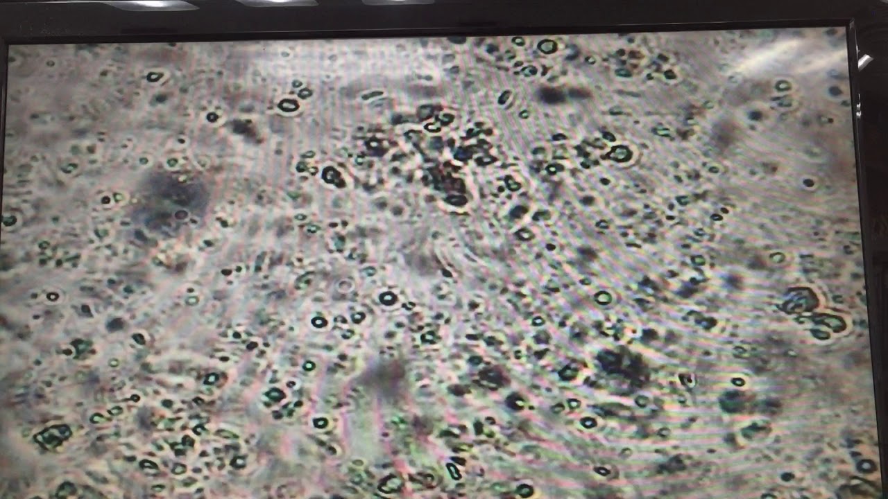 campylobacter in cat's stool under microscope - YouTube