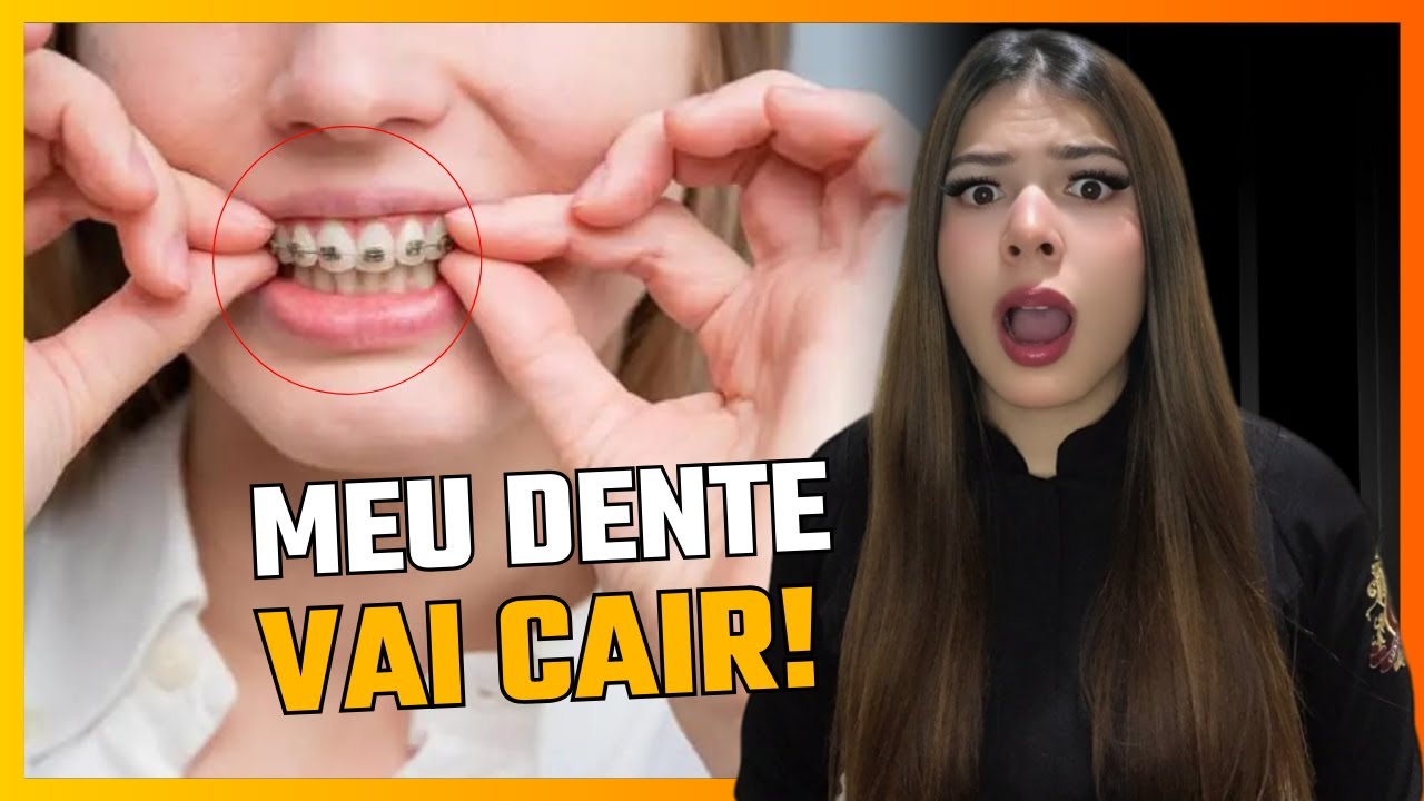 Dente Mole usando Aparelho Ortodôntico: Entenda o Motivo - YouTube