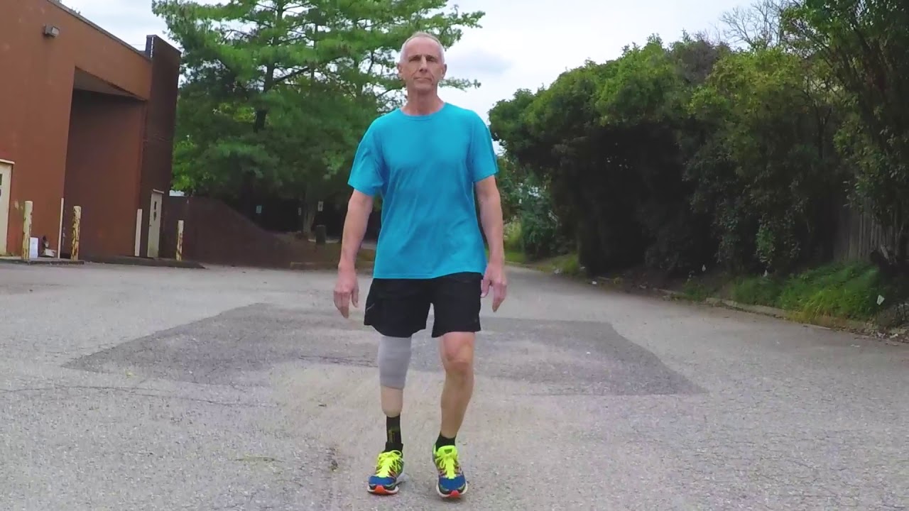 Below Knee Prosthetic Gait Example with Cheetah® Xplore foot | Anterior ...