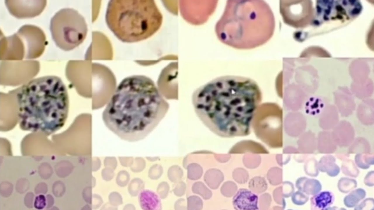 Protozoarios apicomplexa, Plasmodium parte 1 - YouTube