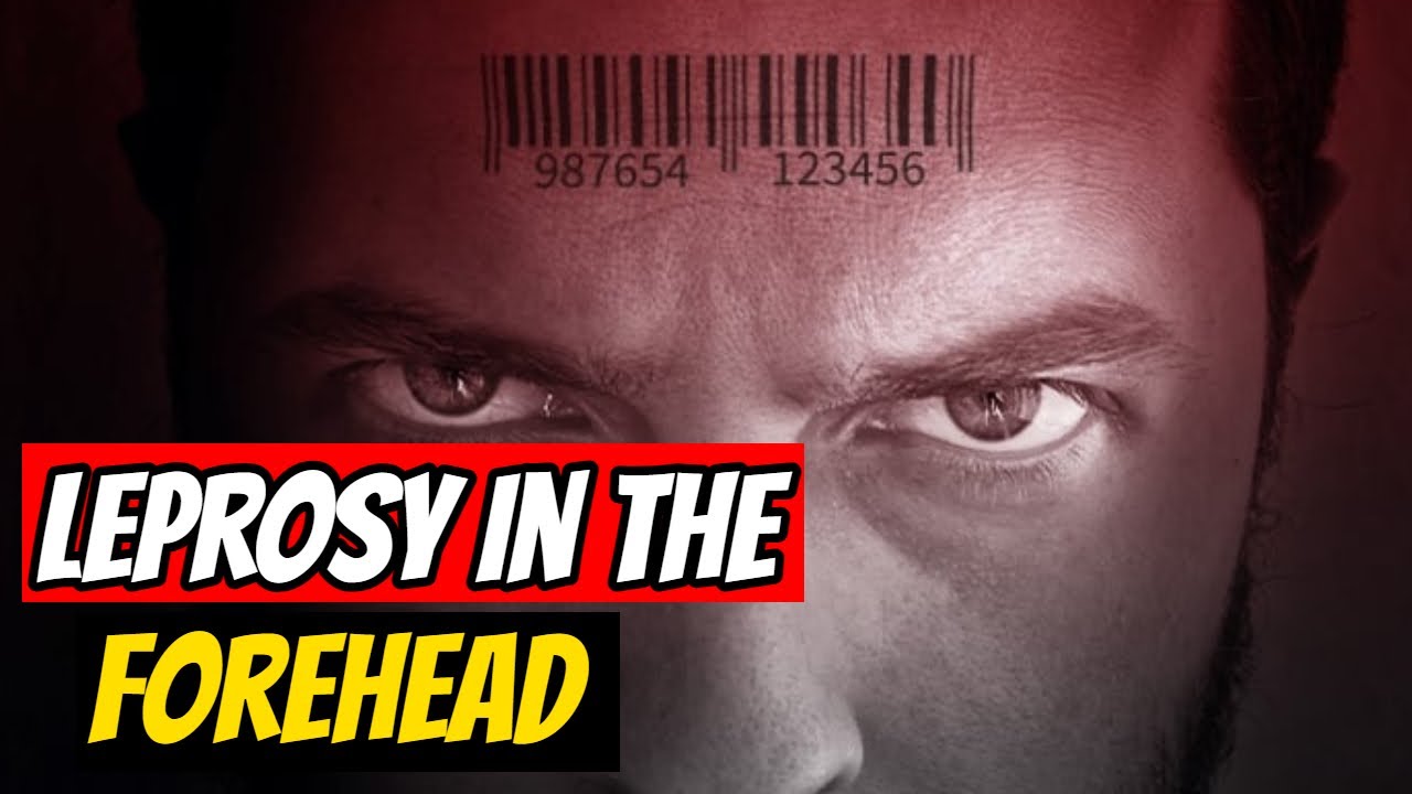 Leprosy In The Forehead - Azariah VS King Uzziah Bible Interpretation ...