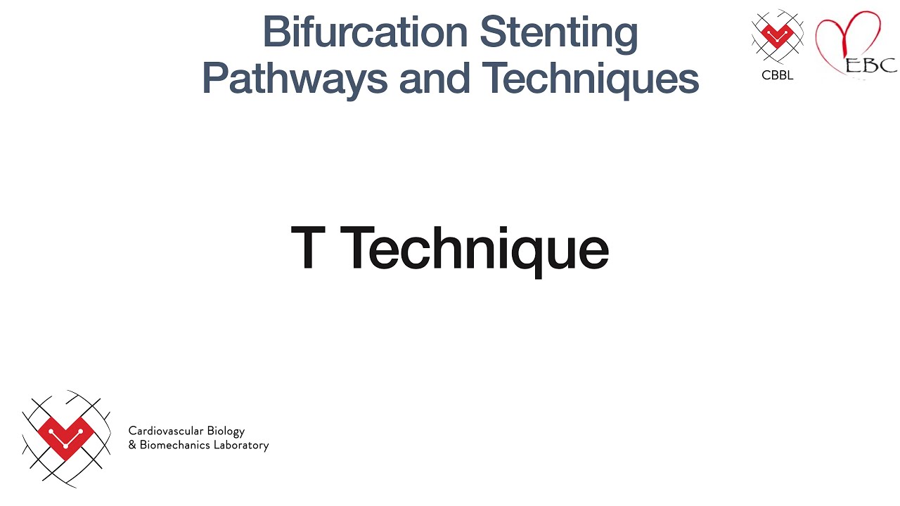 T Technique - YouTube