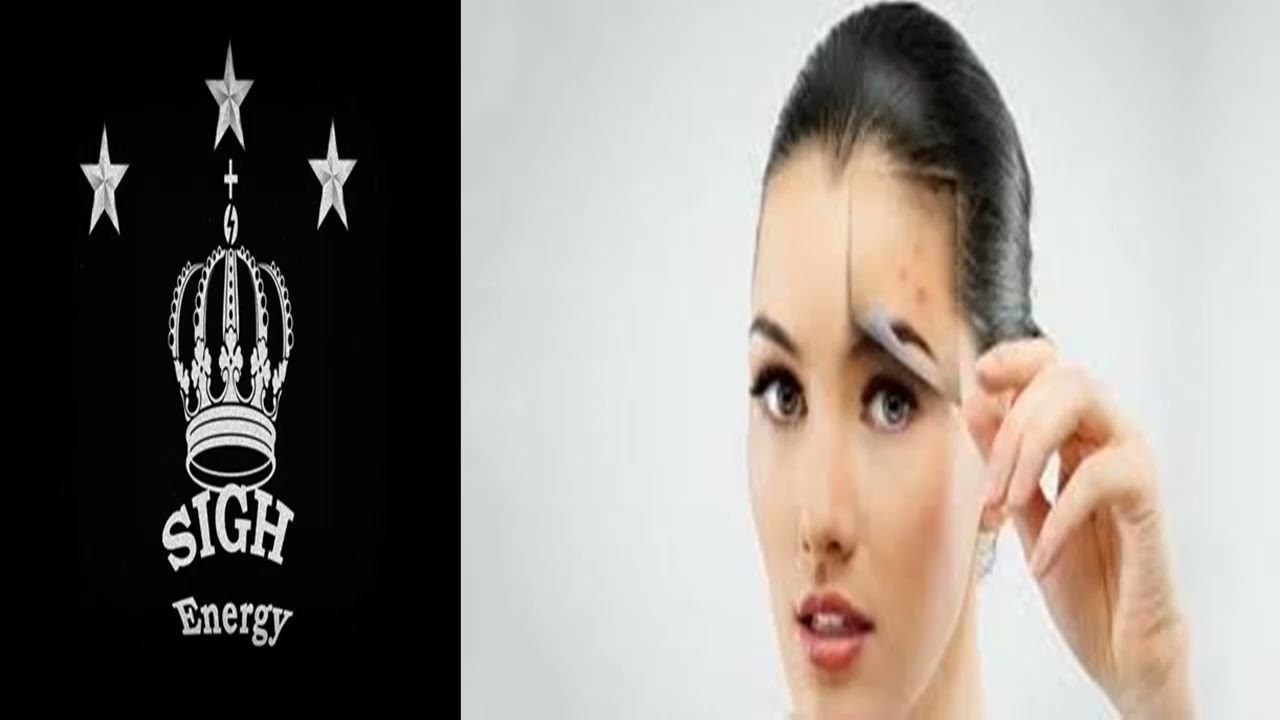 Acne marks/ Scars Treatment EXTREMELY POWERFUL!!! (Energetically ...