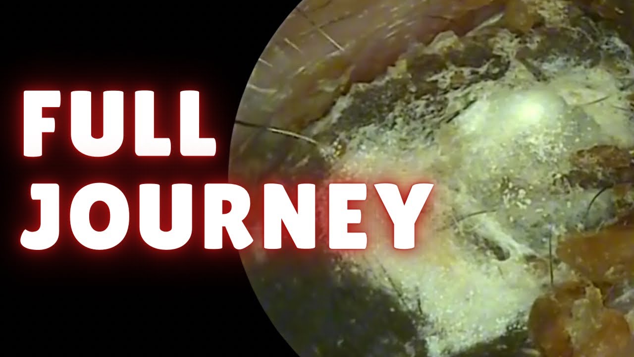Full Journey : Stunning Tarnished Ear Fungal Colony - YouTube