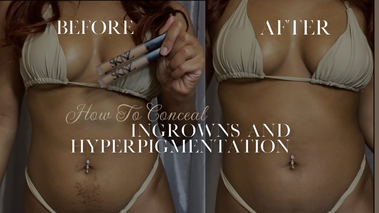 Get The SECRET To The Perfect Bikini Line | SKINZ&CO - YouTube