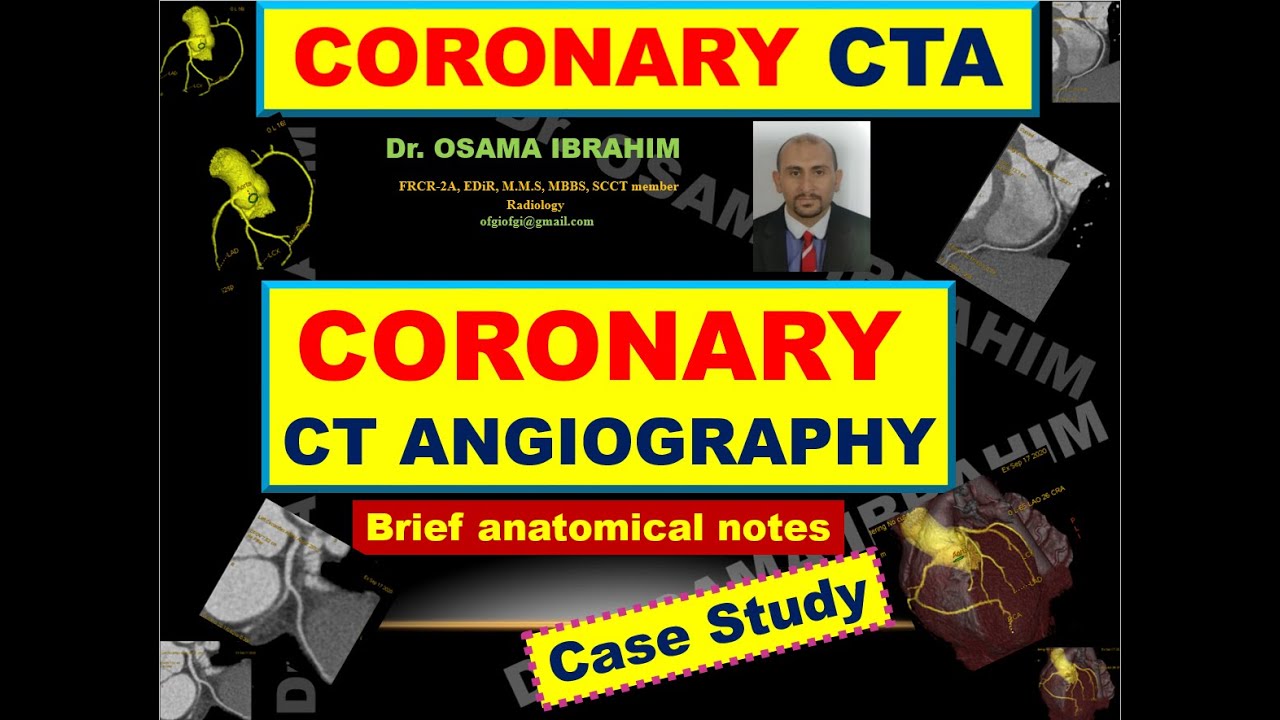 Coronary CTA brief anatomical notes (case study) - YouTube