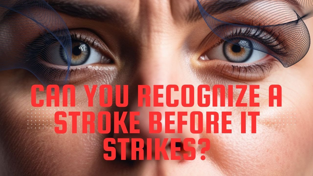 Stroke Warning Signs You Shouldn't Ignore: Real-Life Story - YouTube