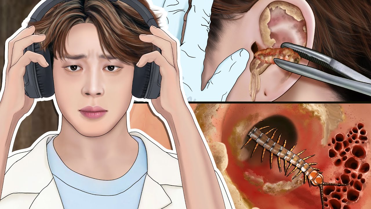 Trypophobia! ASMR 귀에서 구더기와 곤충를 제거하는 애니메이션 | Ear Maggots And Insects ...