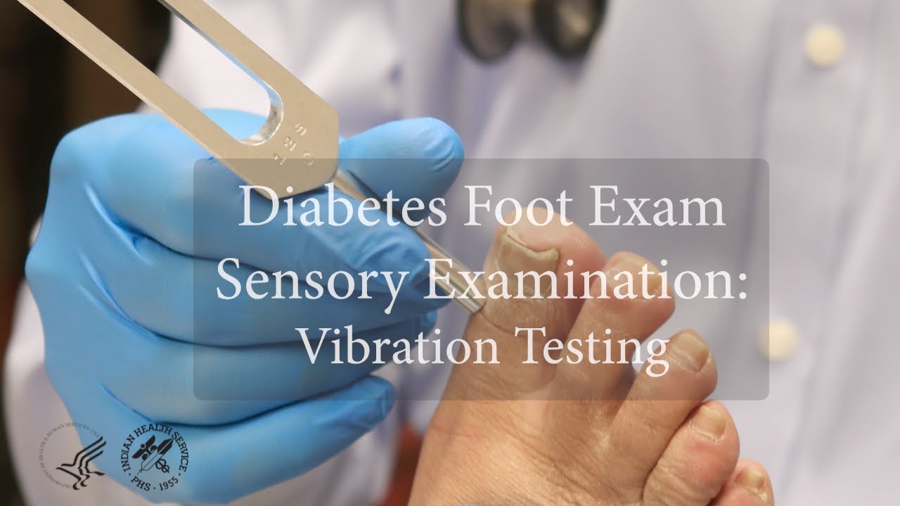 IHS Foot Care Vibration Sensation Testing - YouTube