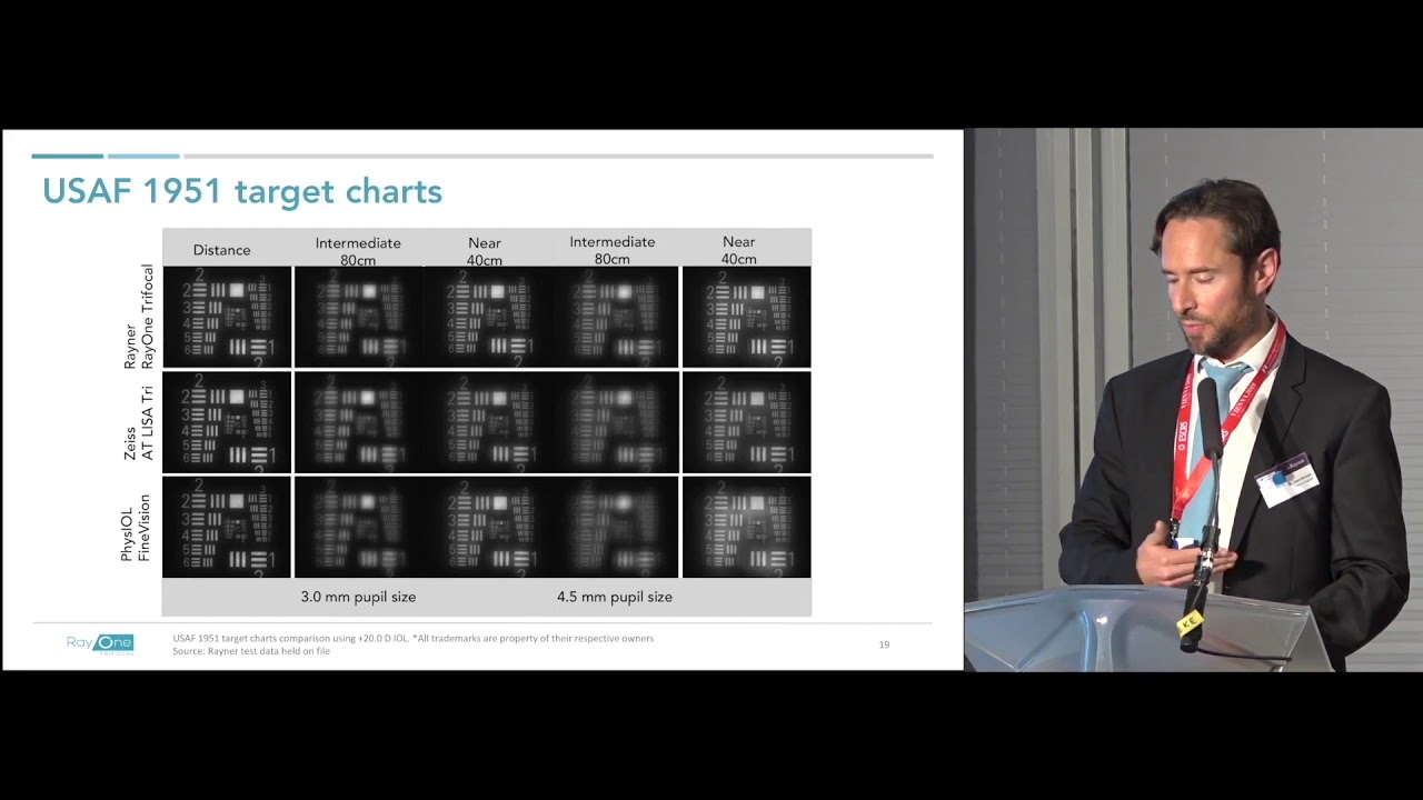 Visual Outcomes With the RayOne Trifocal IOL by Allon Barsam, MD, MA ...