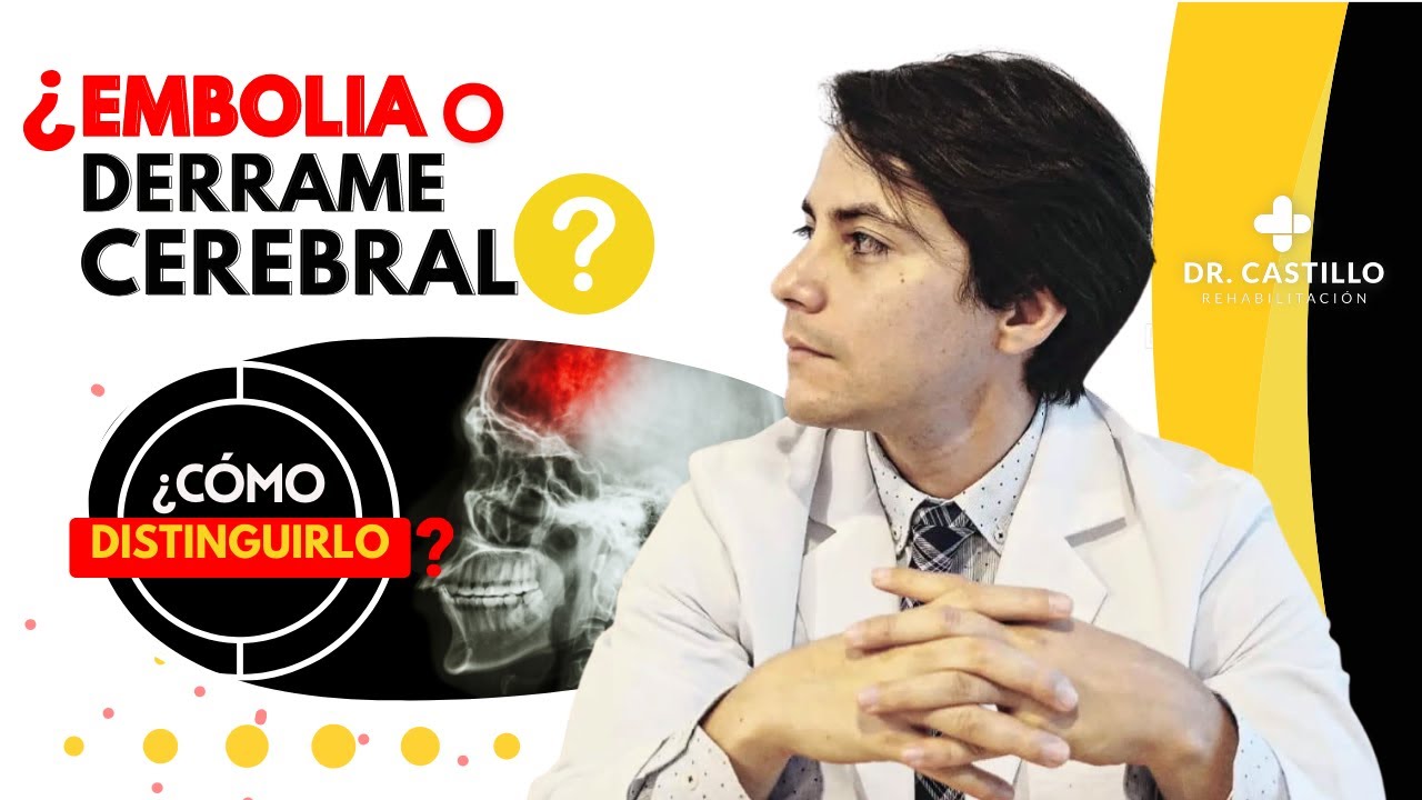 Embolia O Derrame Cerebral ¿qué Hacer Si Sufriste Un Infarto Cerebral