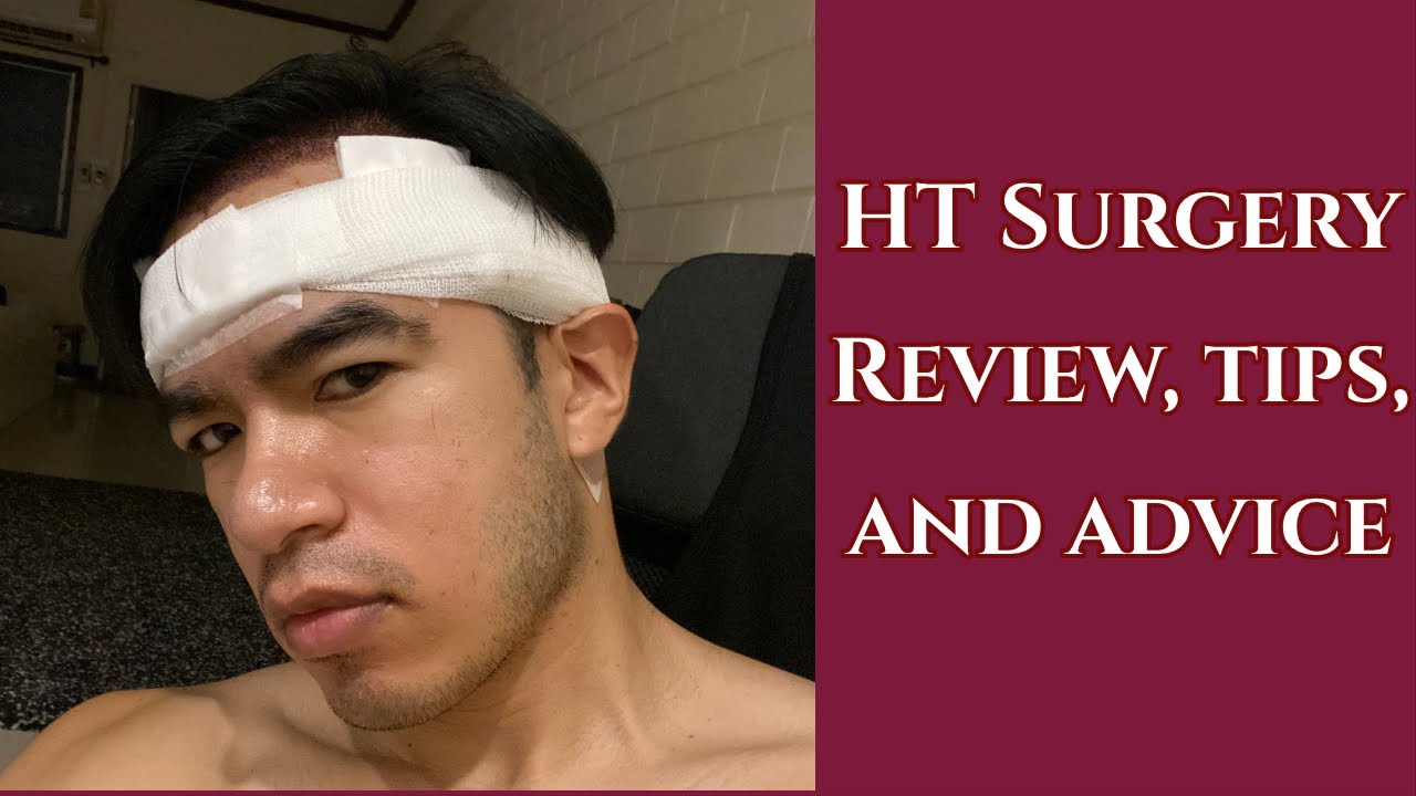 Hair Transplant Surgery Review, Tips, and Advice | DHT Clinic (Bangkok ...