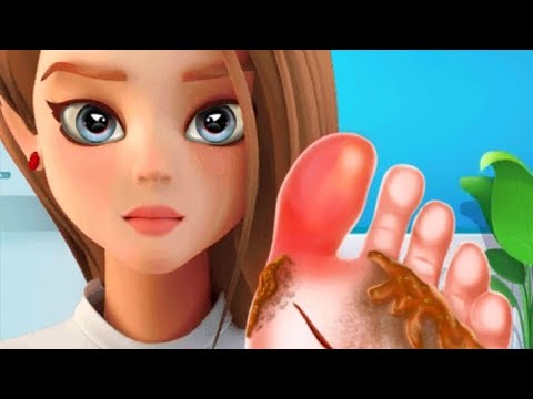 Foot treatment game new 2023 - YouTube