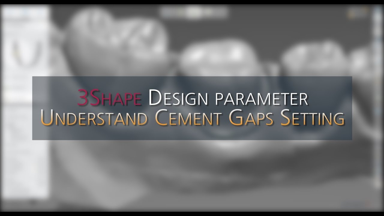 3Shape Cement Gaps - 크라운 적합을 한방에 - YouTube