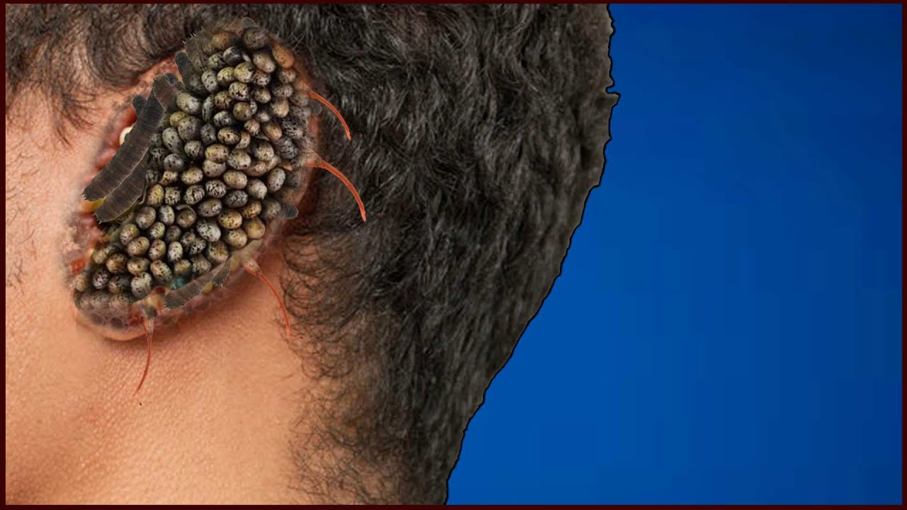 man ear treatment by ASMR |2D animation maggots holes extra skin and ...