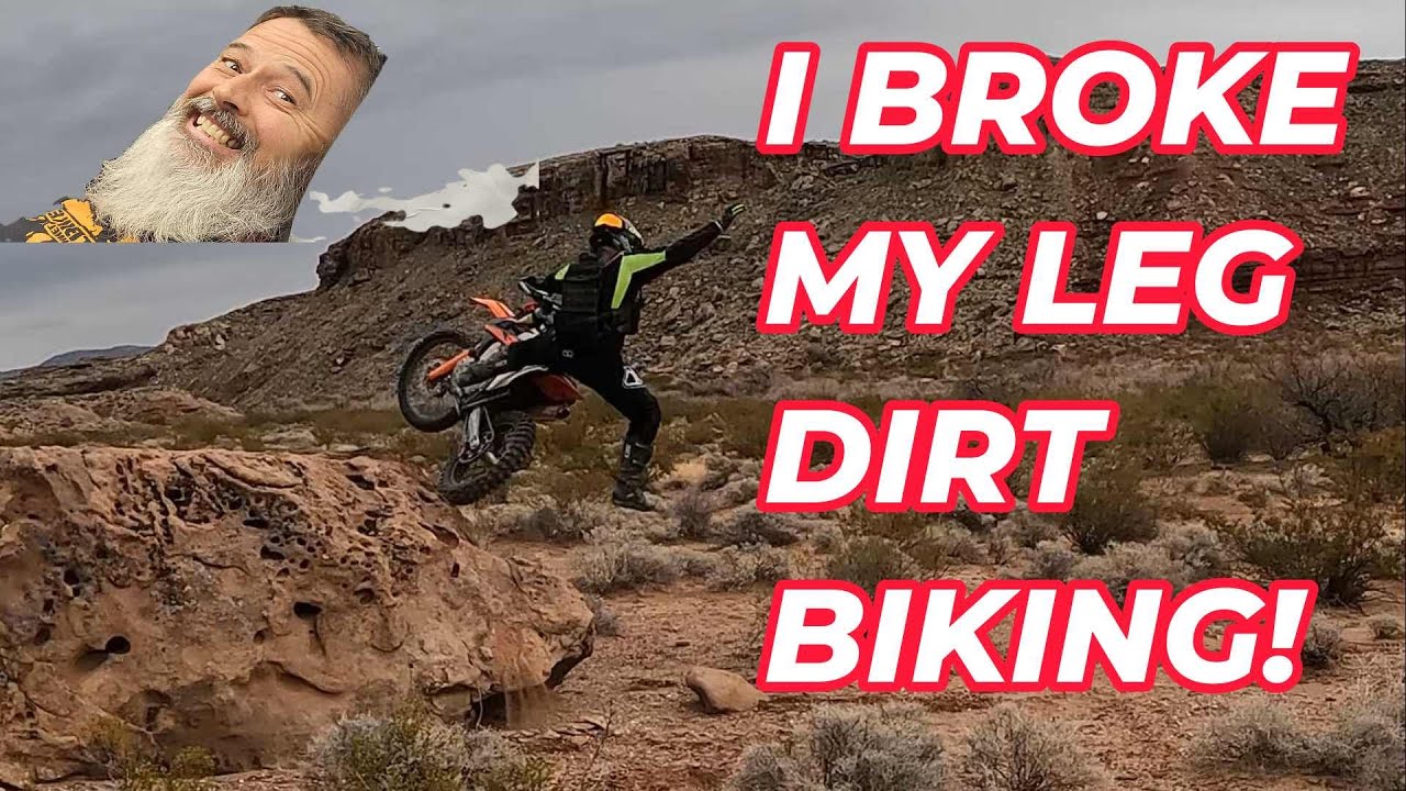 I broke my leg dirt biking!!! - YouTube
