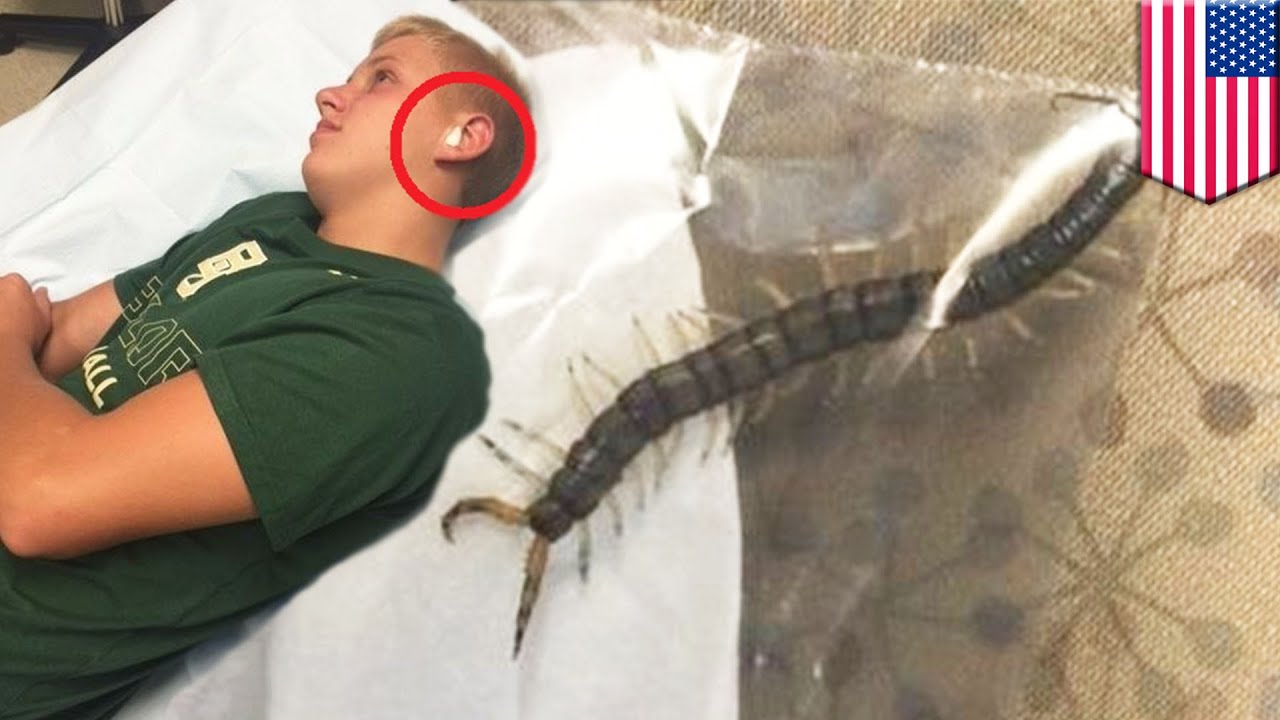 내 귓구멍 속에 꿈지럭 꿈지럭 지네 한마리 - YouTube